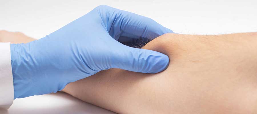 Yağ Bezesi (Lipom) Nedir? - Genel Cerrahi » Özel Rumeli Hastanesi